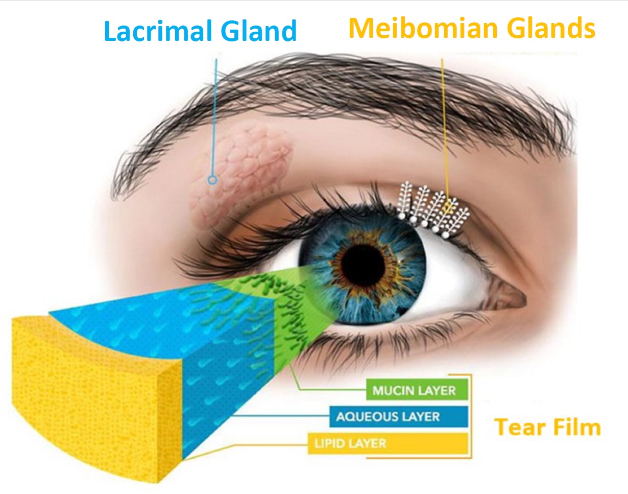 Diagnosing and Treating Inflammatory OSD(Ocular Surface Disease ...