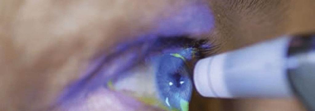 Glaucoma - Scope Connect